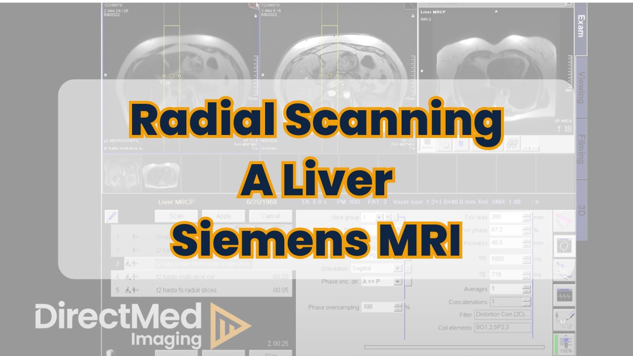 Tech Tip - Radial Scanning a Liver - Siemens MR - DirectMed Imaging